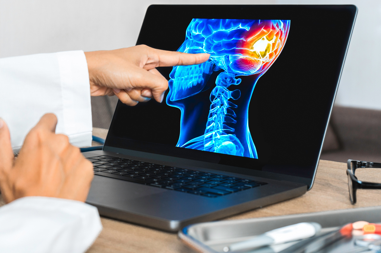 5 Factors That Complicate a Brain Injury Case - Hollis Law